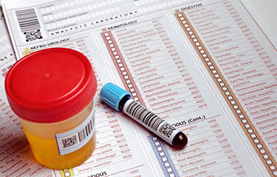 Características de la orina normal » Blog de Biología